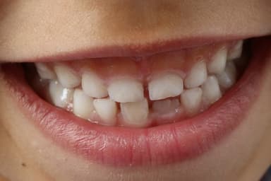 Looking after our teeth: plan and do (non-statutory) KS2 | Y4 Science ...