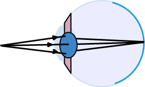 Scale diagrams for convex lenses (including magnification) Foundation ...