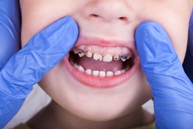 Looking after our teeth: plan and do (non-statutory) KS2 | Y4 Science ...
